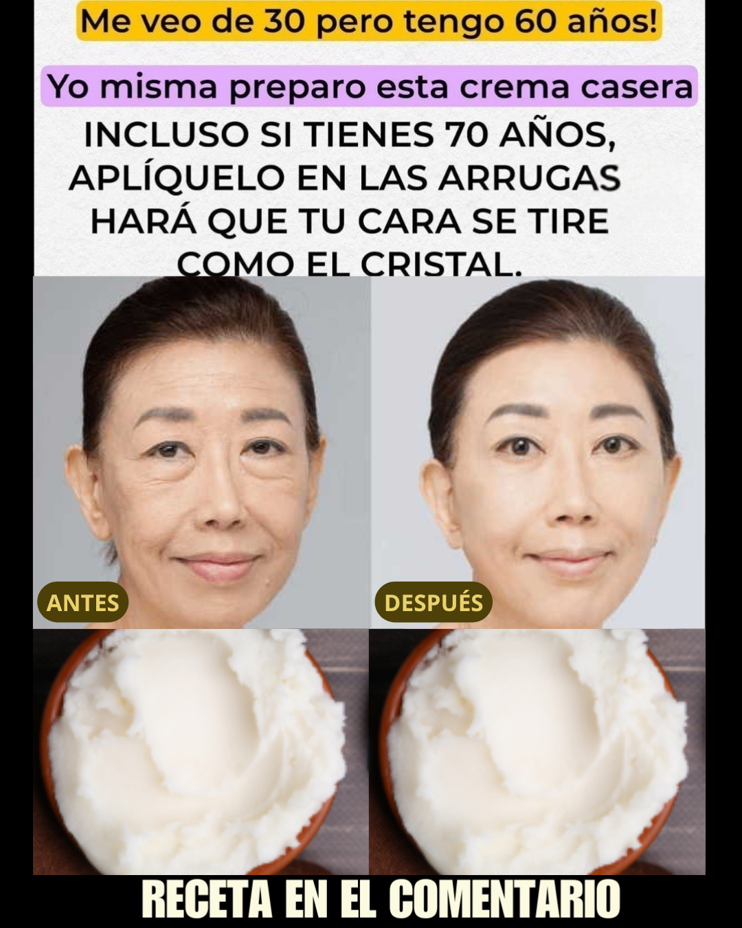 Crema Casera de Bicarbonato: Despídete de las Arrugas y Manchas en la ...